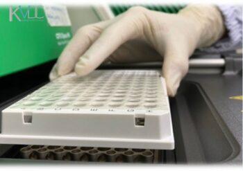 หลักการพื้นฐานของเทคนิค Real- time PCR และการอ่านผลการทดสอบ